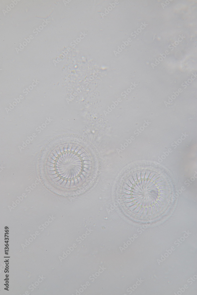 Gills of fish ,protozoa and Trichodina spp. under the microscope.(soft ...