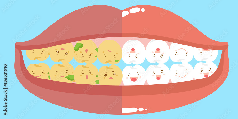 cartoon health and tooth decay Stock Vector | Adobe Stock