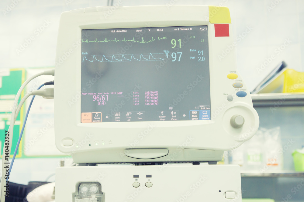 Stock-Foto „EKG monitor in intra aortic balloon pump machine,Heart ...