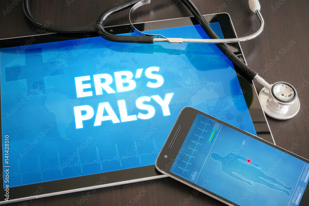 Erb's palsy (neurological disorder) diagnosis medical concept on tablet ...