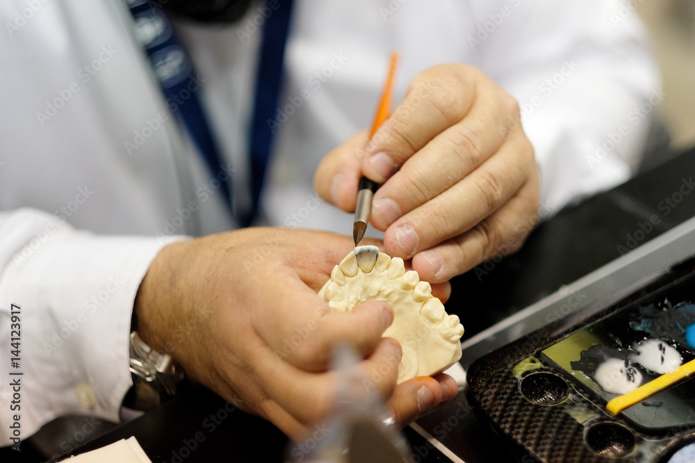 Making an individual tooth crown in a denture laboratory の Stock フォト ...