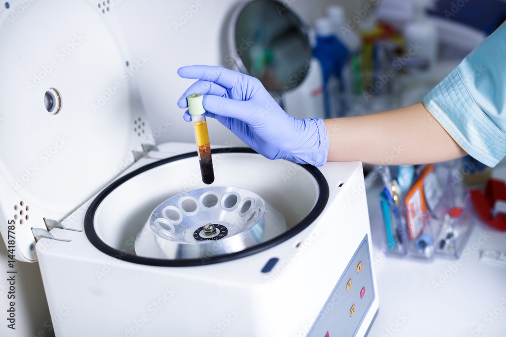 Plasmolifting. Preparation of blood for injections. cosmetologist puts ...