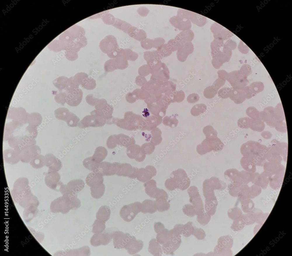 Human parasite under 100X light microscope; thin film of blood smear ...