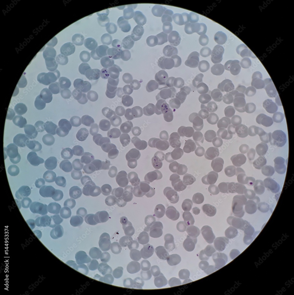Human parasite under 100X light microscope; thin film of blood smear ...