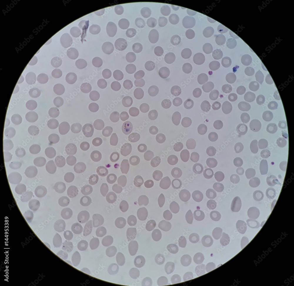 Human parasite under 100X light microscope; thin film of blood smear ...