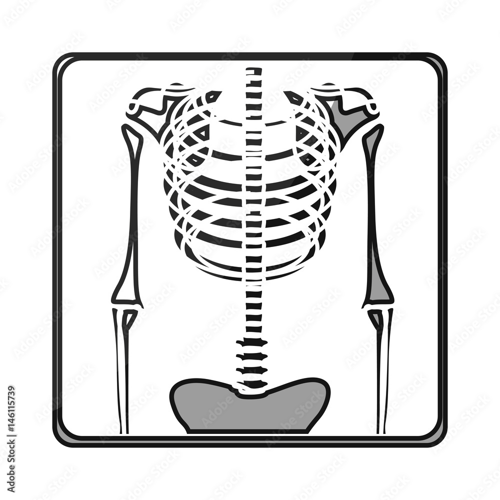 grayscale silhouette with symbol of chest radiography vector ...