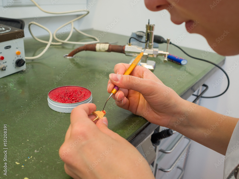 Dental technician applying wax on a tooth stump の Stock フォト | Adobe Stock