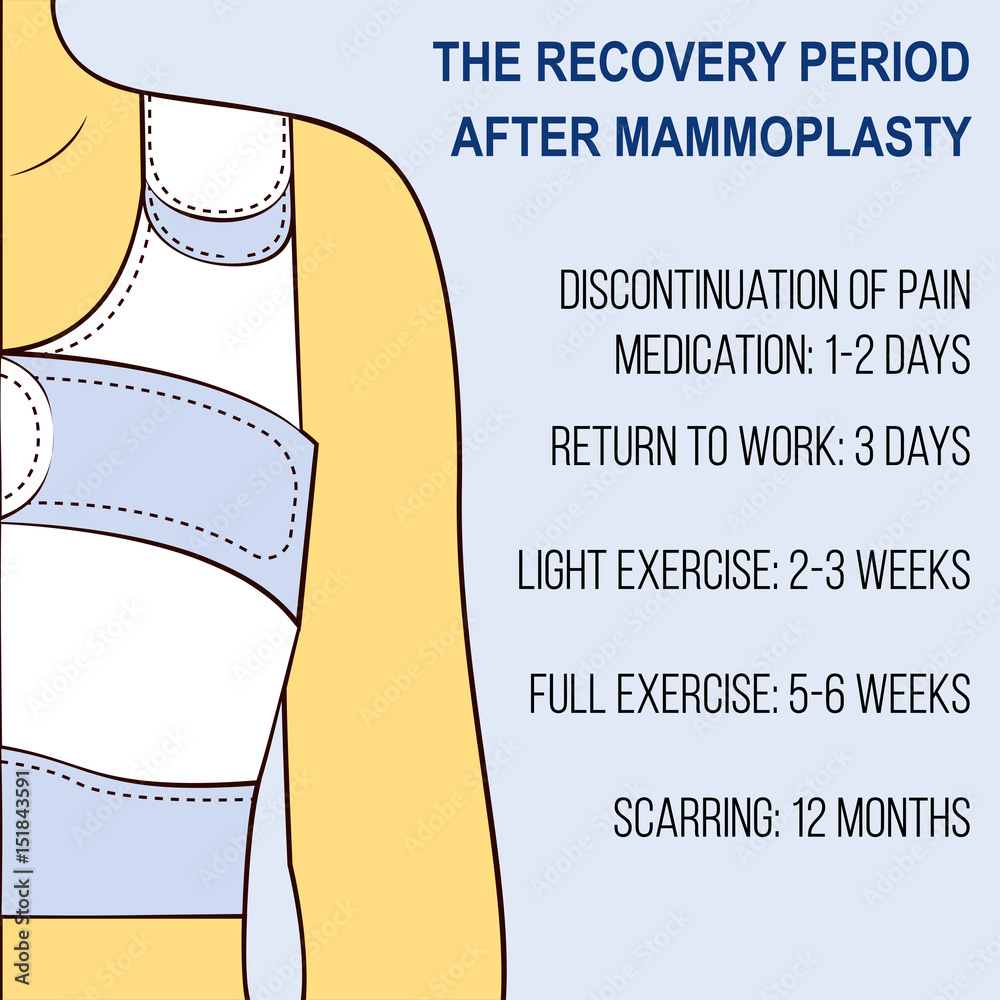 Plastic breast surgery Recovery period after plastic surgery Vector ...