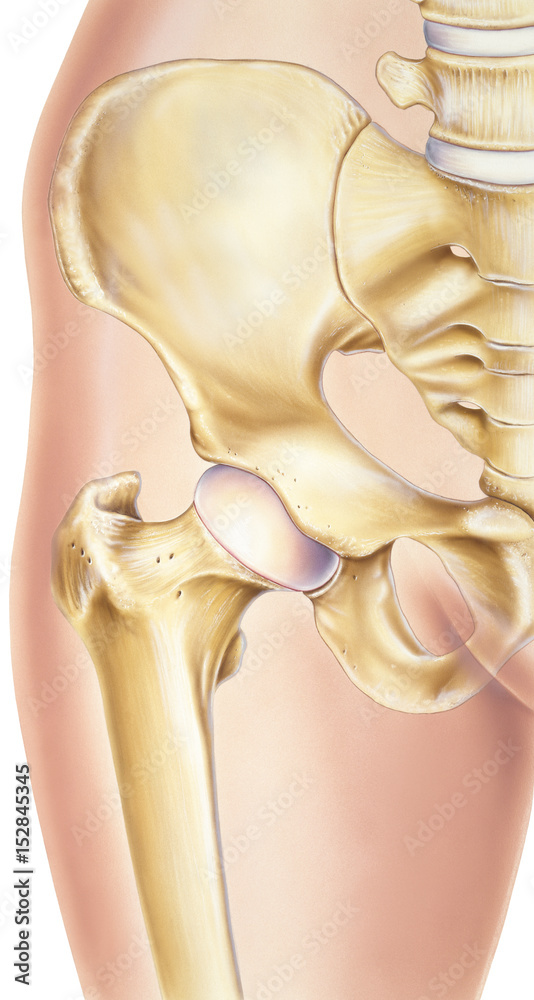 Shown is a normal human hip with the bones and joints visible ...