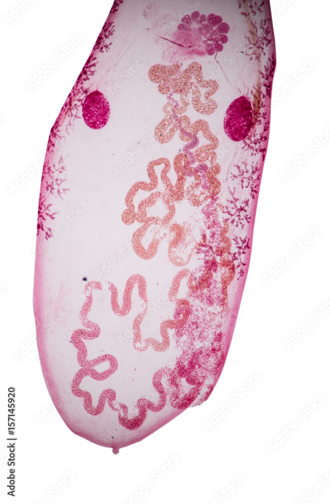 Fish diseases and parasites under microscope view. Stock Photo | Adobe ...