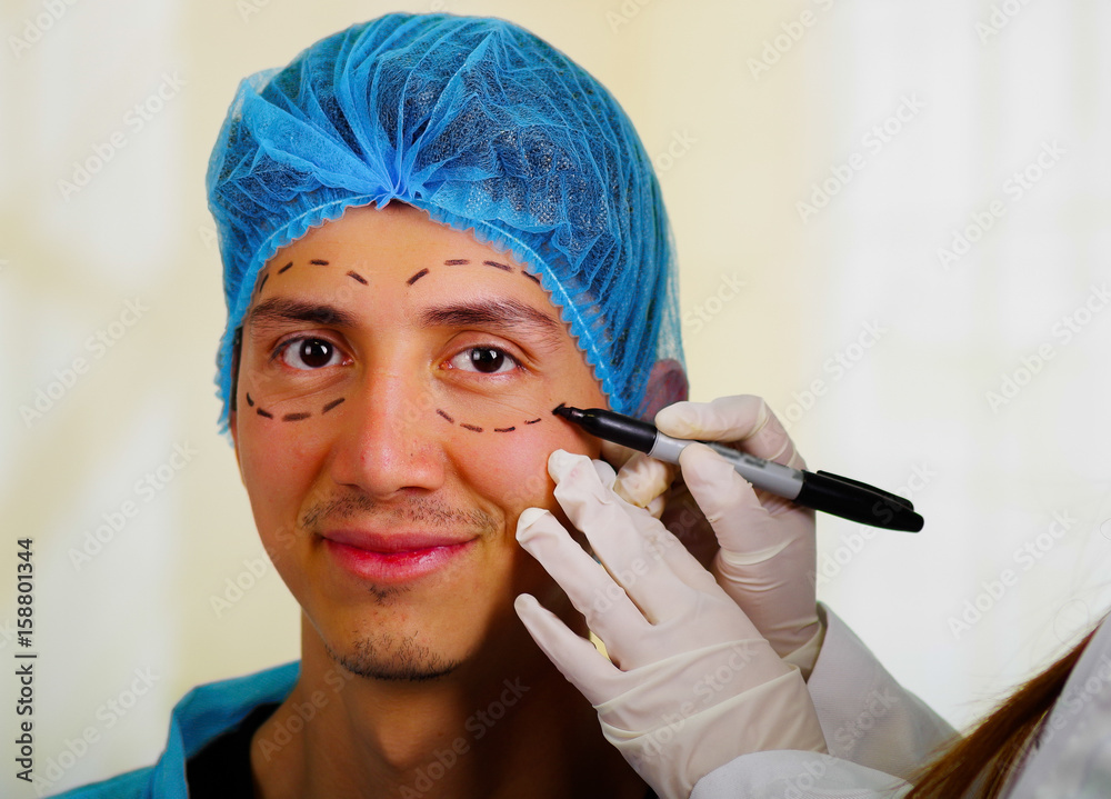 Surgeon drawing marks on male face. Plastic surgery concept Stock Photo ...