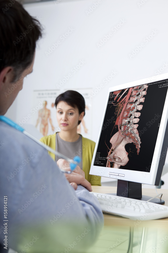 Models On screen, 3D angiography scanner Study of the blood ...