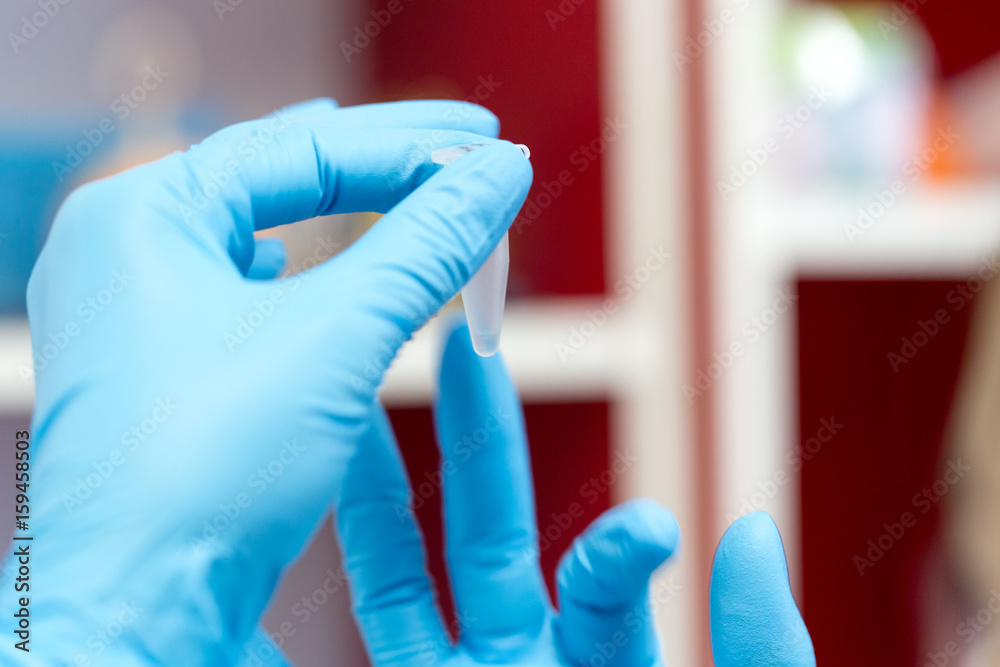 Equipment for analyze samples into the agarose gel and for the ...