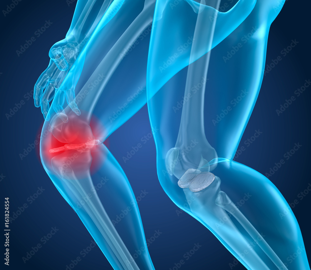 Knee pain Attack, man suffering from spinal knee. 3D illustration Stock ...