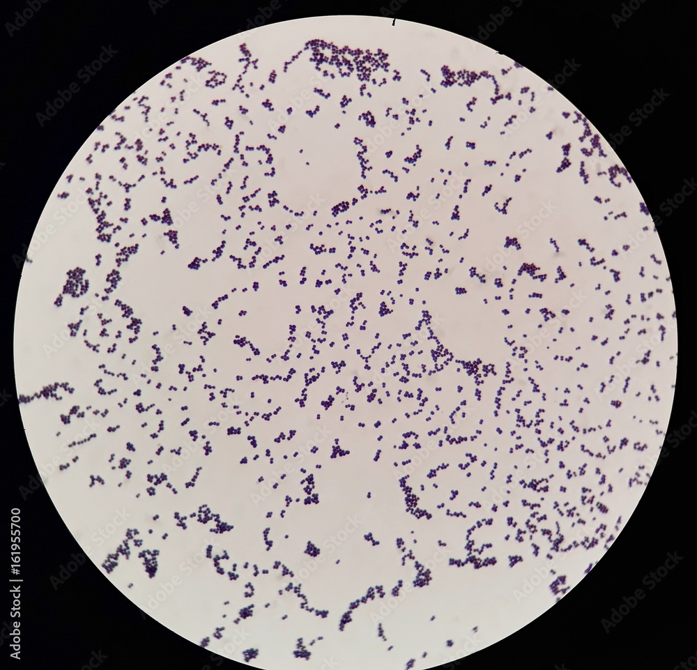 Smear of gram positive cocci bacteria under 100X light microscope ...
