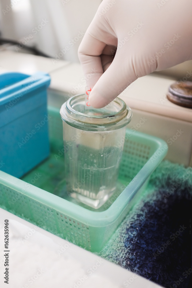 Fix slide CBC with methanol method ,CBC slide Stock Photo | Adobe Stock