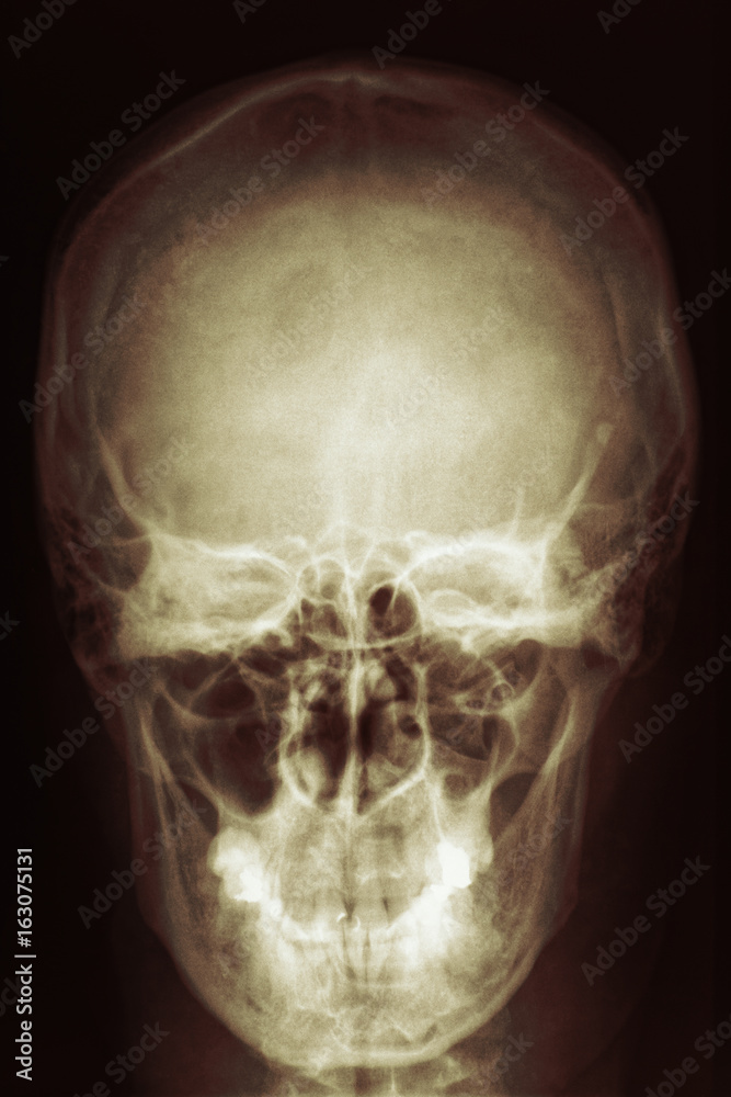 Foto de Stock Skul head radiology scan by X-rays | Adobe Stock