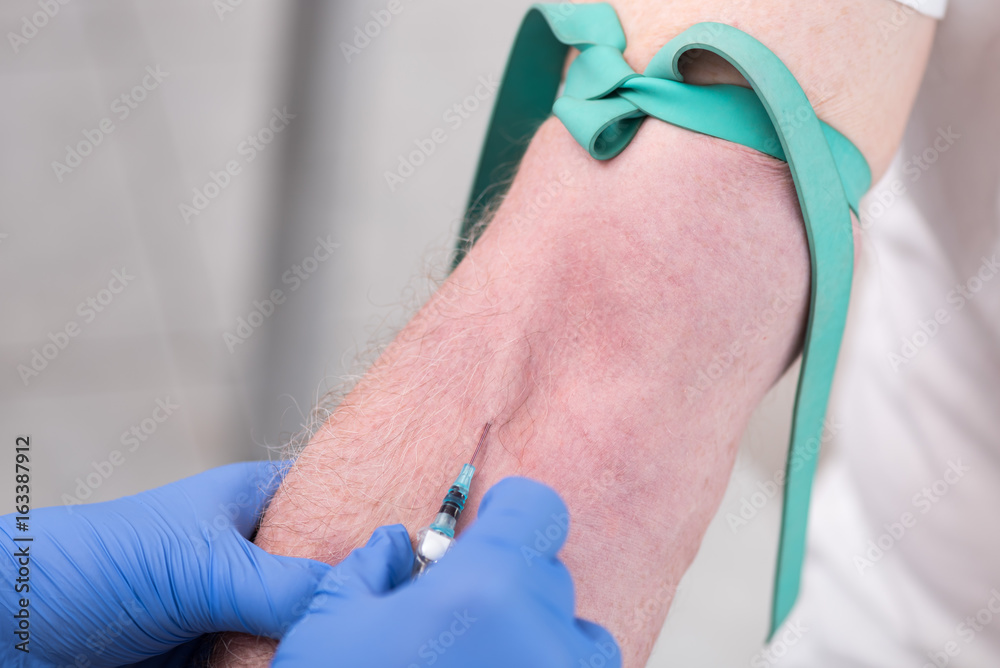 Injection of a catheter in the arm Stock Photo | Adobe Stock
