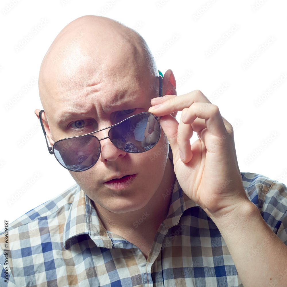 Autoimmune total alopecia men portrait. Absolute bald head without ...