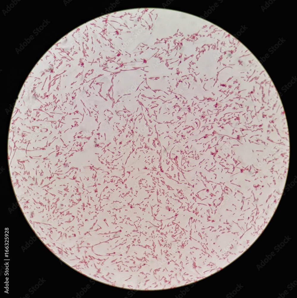 Smear of gram negative bacilli bacteria under 100X light microscope ...