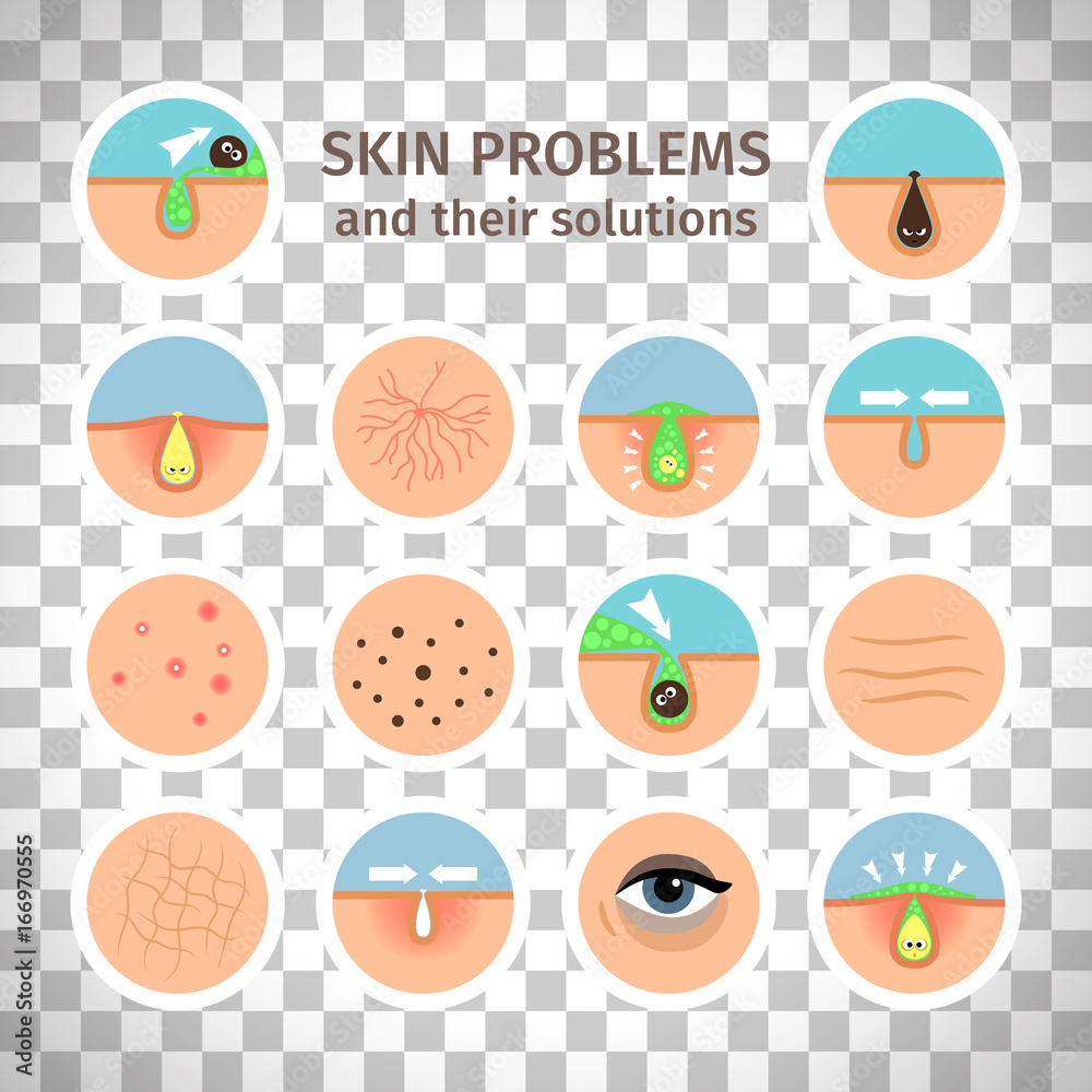 Skin problem icons on transparent background Stock Vector | Adobe Stock