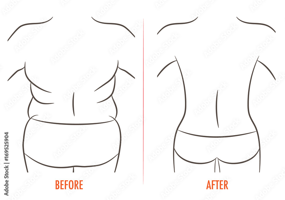 Thick and thin, overweight problem concept. Female torso with fat and ...