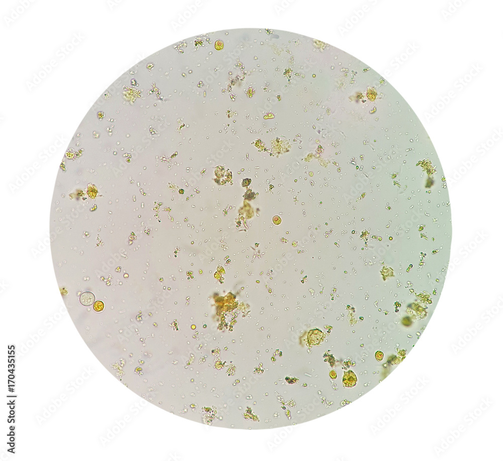 Stool parasites examination test for parasites or eggs in human stool ...