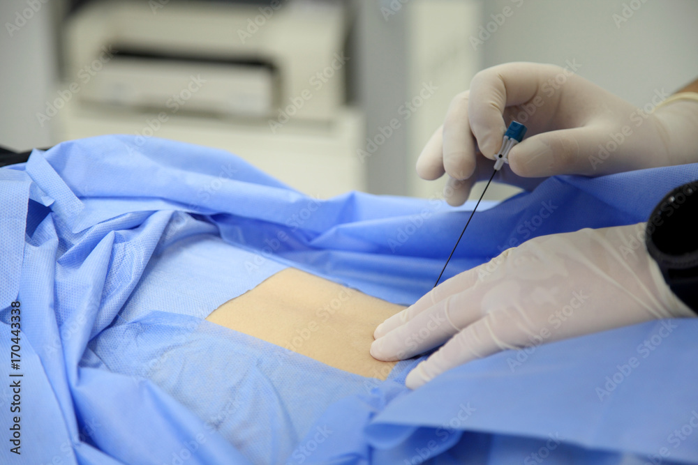 Treatment of acute pain in the spine. Epidural block. Man patient ...