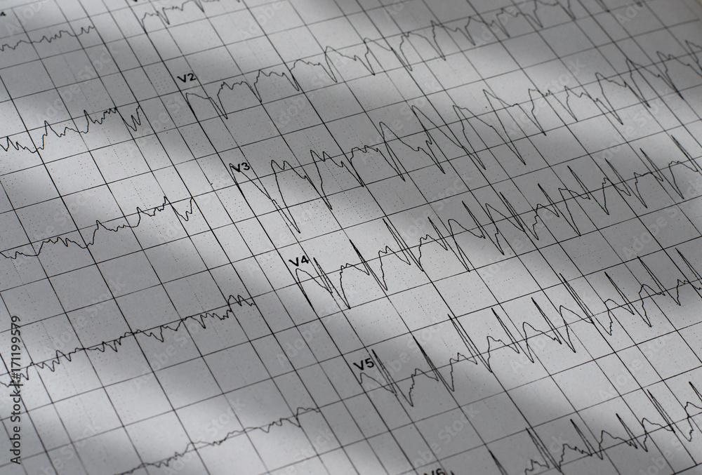 Electrocardiogram chart as medical background Stock Photo | Adobe Stock