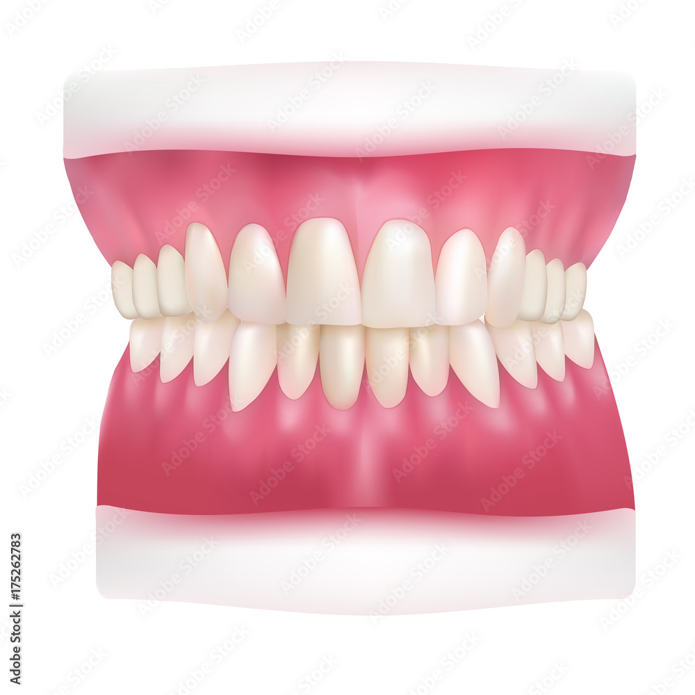 Vector illustration of realistic dentures. Human jaw model, gradient ...