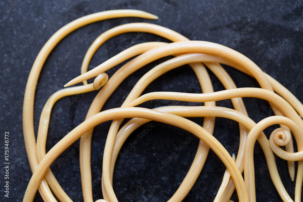 Ascariasis is a disease caused by the parasitic roundworm Ascaris ...