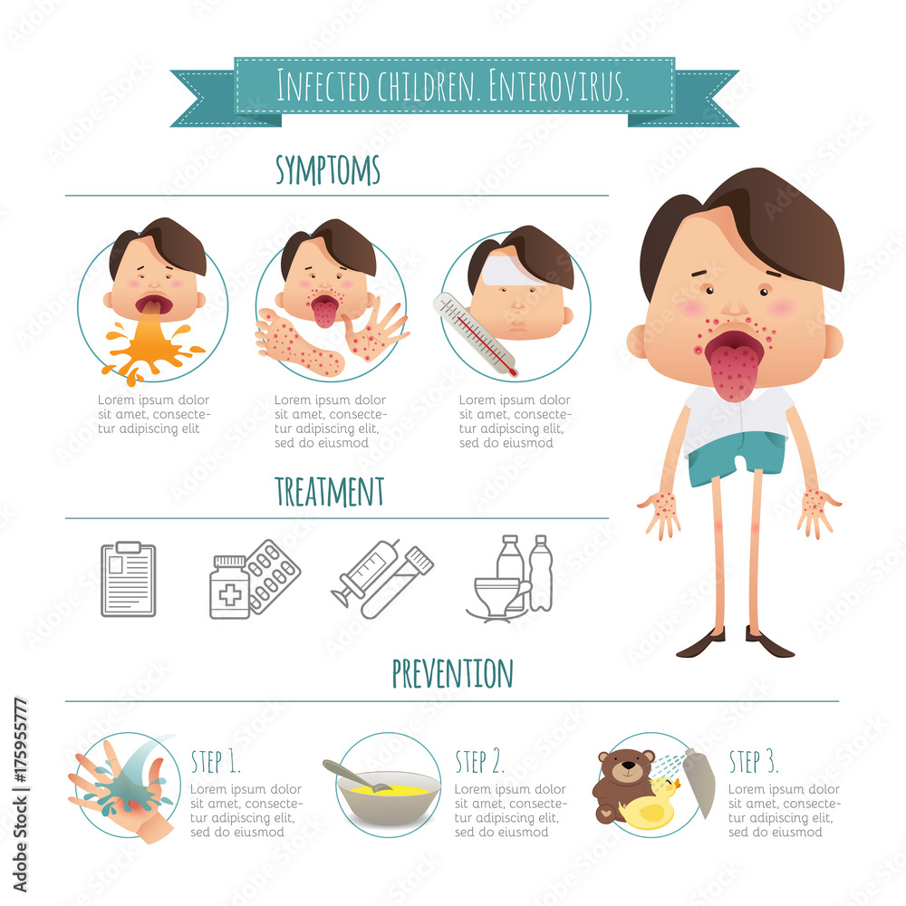 Infected children. Enterovirus. Hand-foot-mouth disease Infographics ...