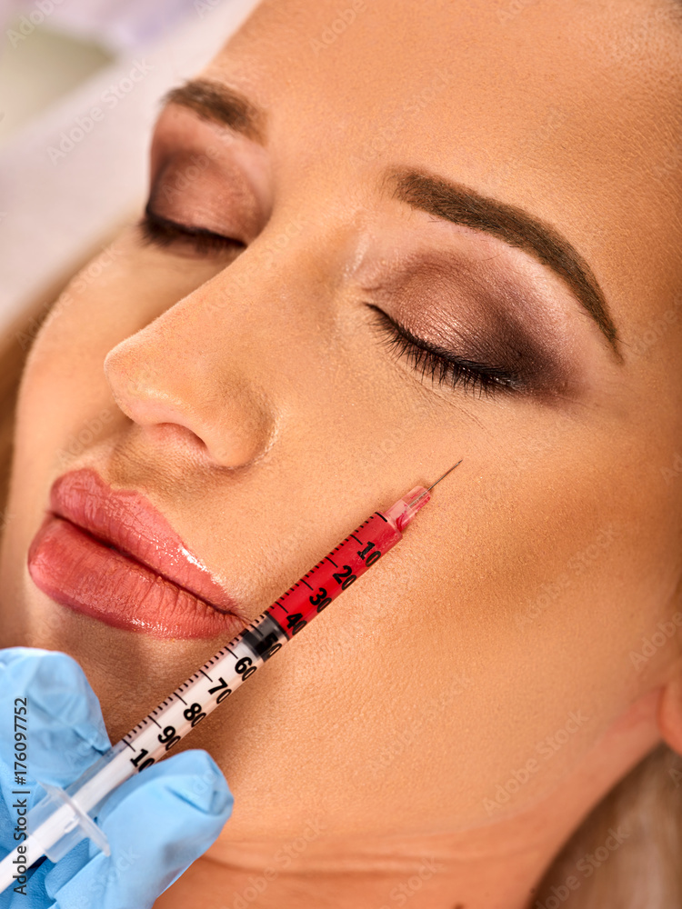Filler injection for female forehead face. Plastic aesthetic facial ...