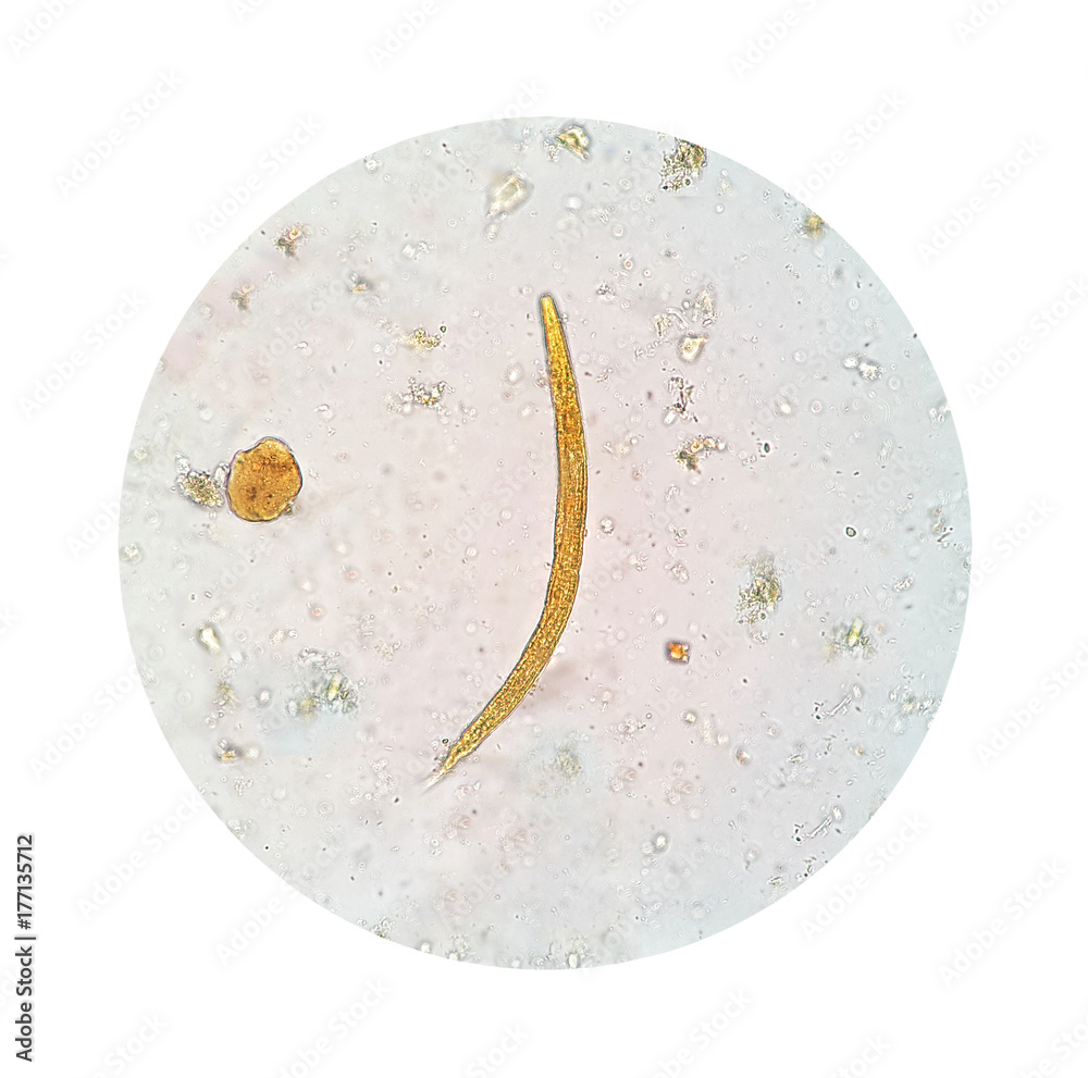 Fotografie Stool parasites examination test for parasites or eggs in ...