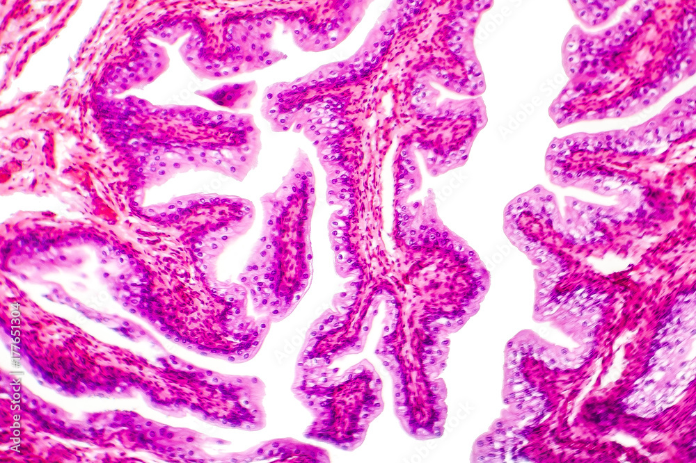 Transitional epithelium tissue of the urinary bladder under microscope ...