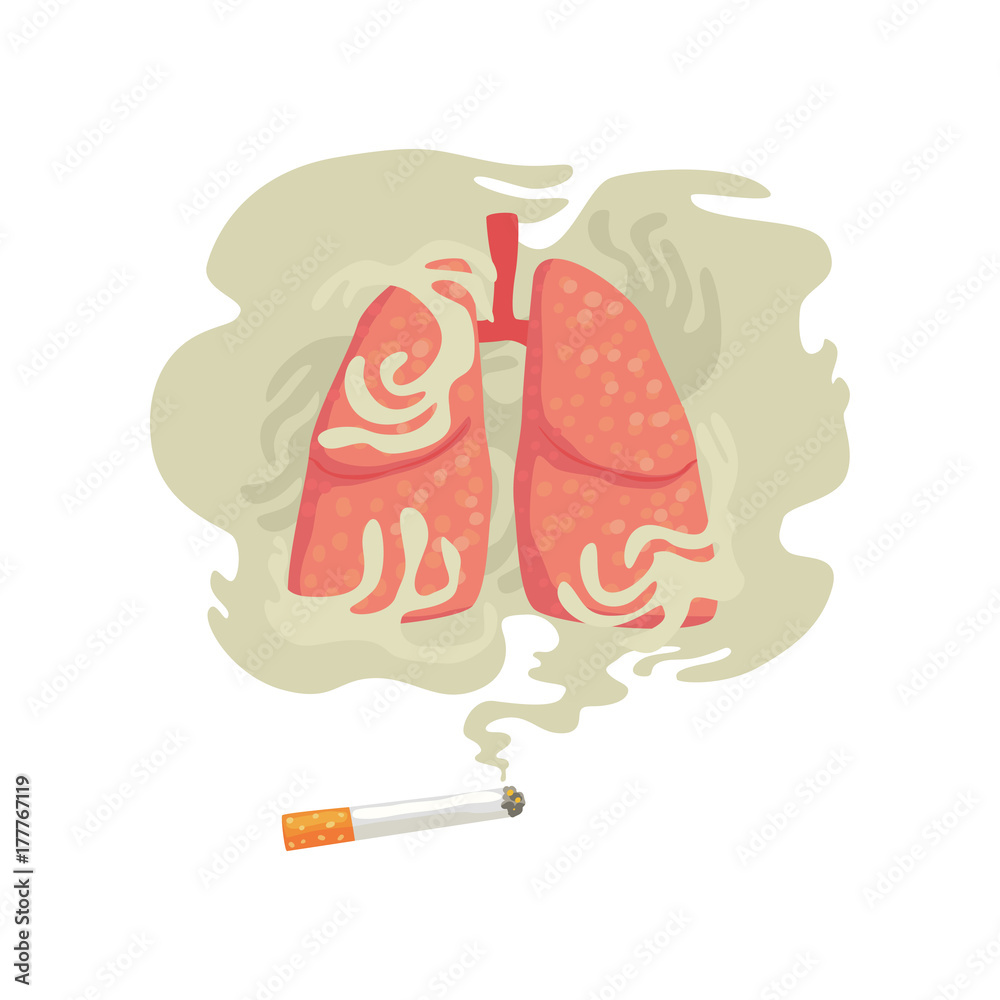 Cigarette smoke and lungs, bad habit, dangers of smoking, nicotine ...