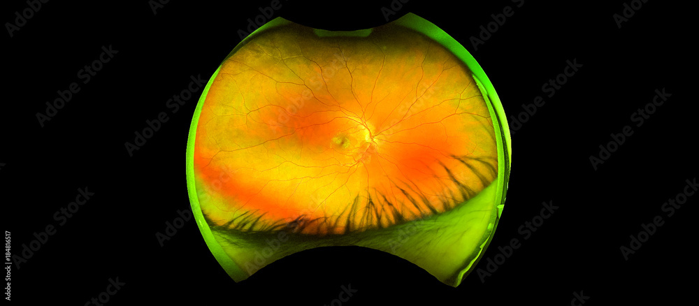 eye's retinal angle image with macula, vessels and optic disc isolated ...