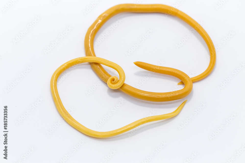 Ascariasis is a disease caused by the parasitic roundworm Ascaris ...
