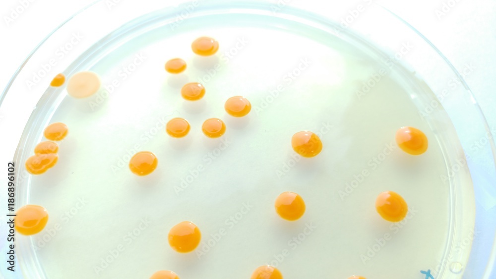 Bacteria Colony Microbiology Laboratory Orange Stock Photo | Adobe Stock