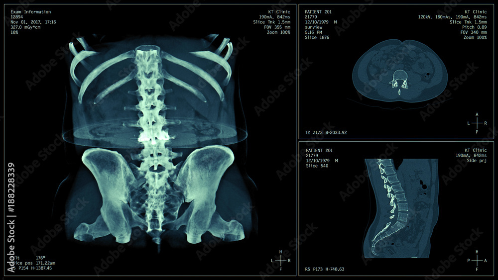 Ilustrace Body CT scan image, radiography x-ray examination, MRI ...