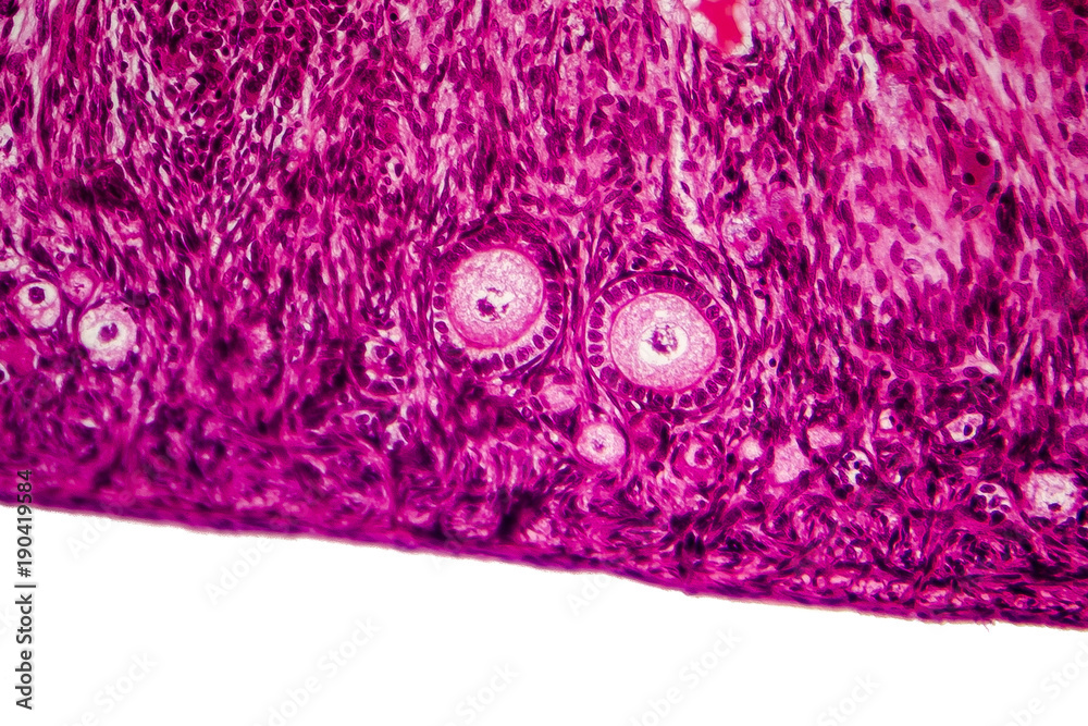 Light micrograph of human ovary showing primary and secondary follicles ...