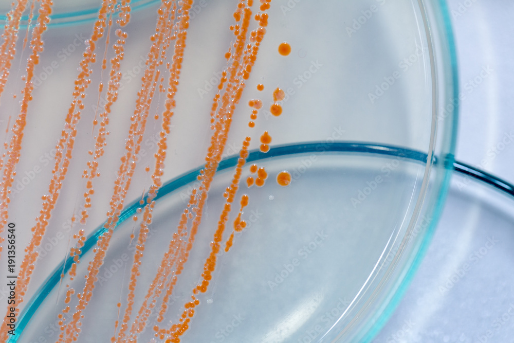 Serratia marcescens is a species of rod-shaped gram-negative bacteria ...