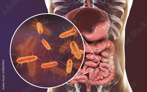 Intestinal microbiome, 3D illustration showing anatomy of human ...