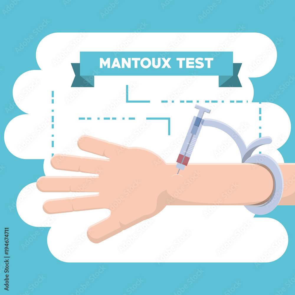 Mantoux test design with hand and injection over blue and white ...