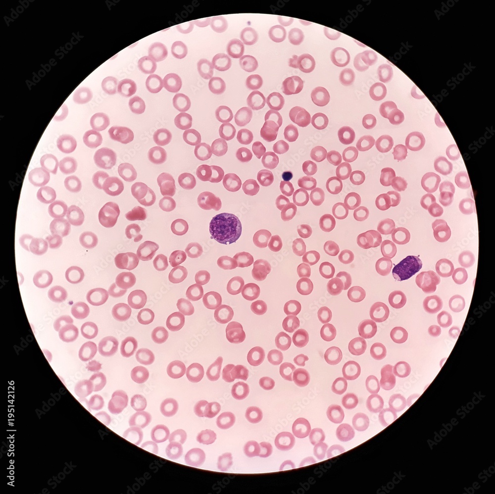 Blood Cells Under Microscope Labeled