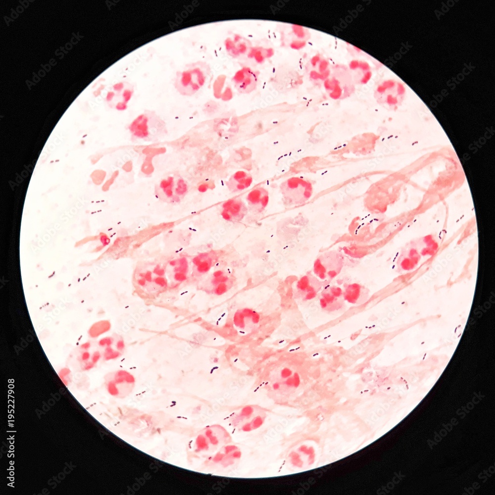 Gram Staining Blood Slides Gram Staining: Principle, Procedure,