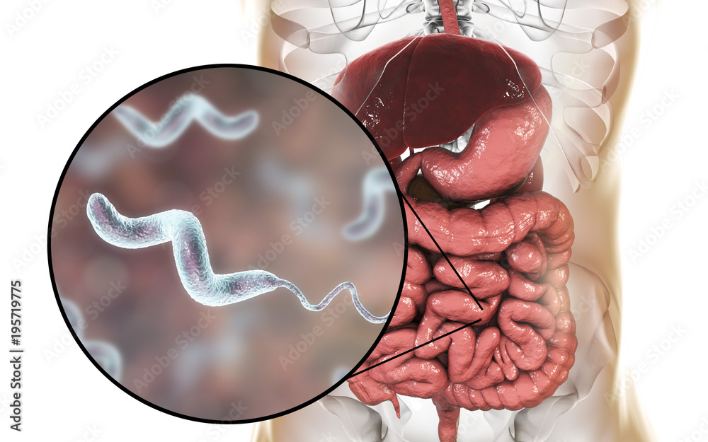 Campylobacter bacteria in intestine, C. jejuni, C. fetus, Gram-negative ...