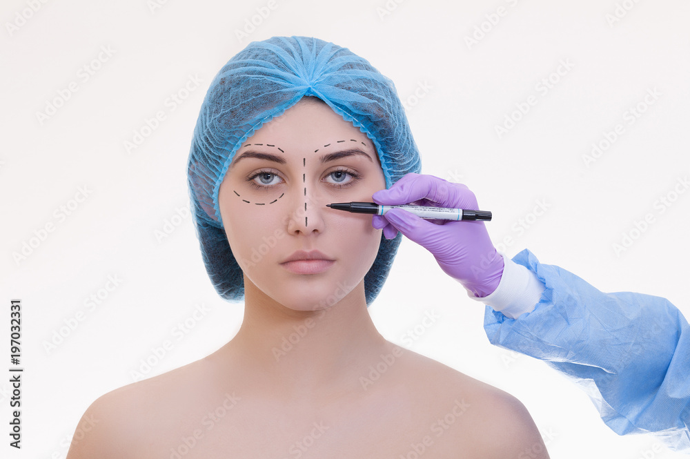 blepharoplasty surgery concept. Doctor drawing marks on female face ...