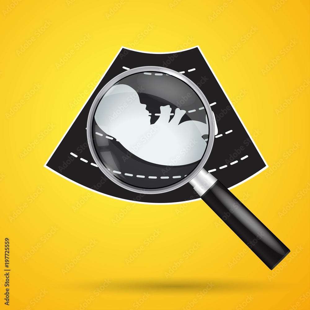 Ultrasonography baby icon. Screening baby. Stock Vector | Adobe Stock