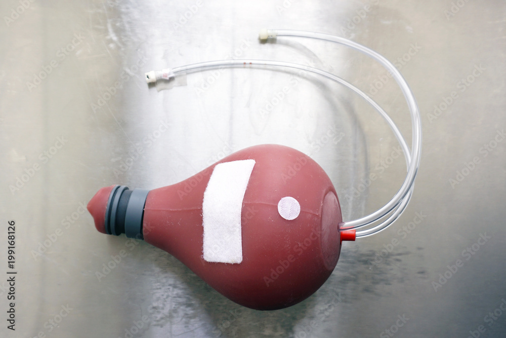 Simulation medicine model of the uterus for urgent treatment of post ...